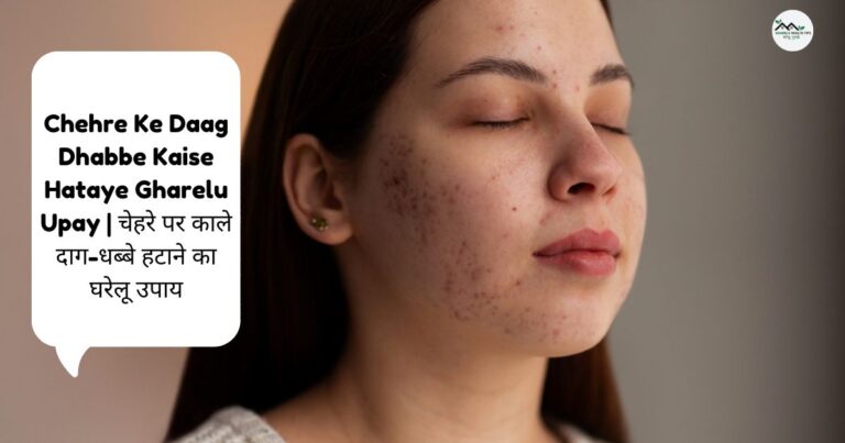 Chehre Ke Daag Dhabbe Kaise Hataye - 100% नैचुरल घरेलू उपाय